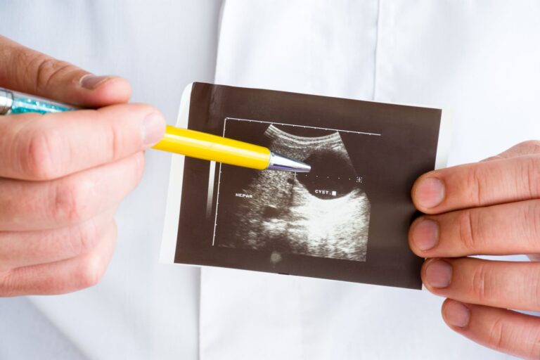Liver Cysts Treatment In Sg United Gastro And Endoscopy Clinic